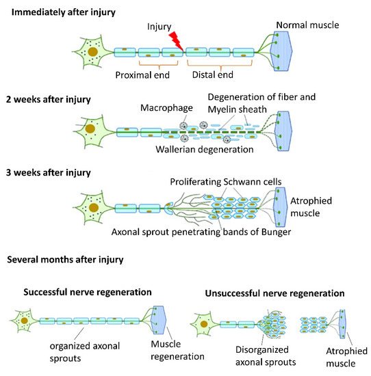Advances in Biomimetic Nerve Guidance Conduits for Peripheral Nerve ...
