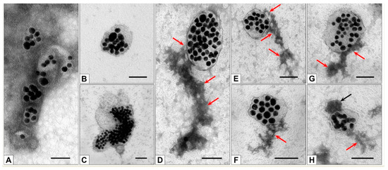 Fixation and Visualization of Full Protein Corona on Lipid Surface of ...