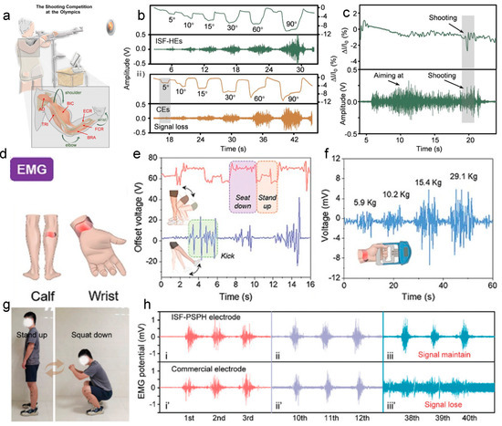 Nanomaterials | Free Full-Text | Recent Advances of Stretchable ...