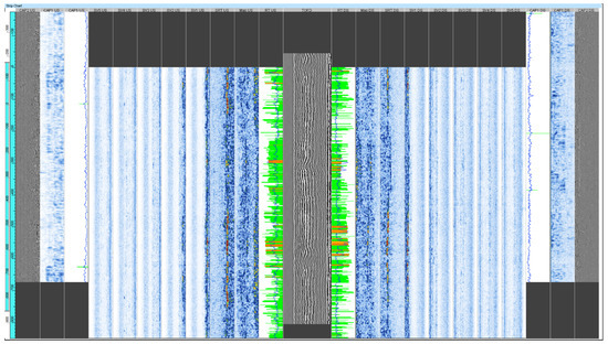 Automated Weld Defect Detection in Industrial Ultrasonic B-Scan Images ...
