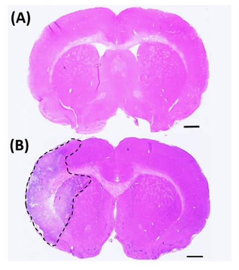Neuroglia | Free Full-Text | Temporal Profile of Reactive Astrocytes ...