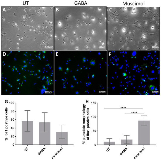 A Human Microglial Cell Line Expresses γ-Aminobutyric Acid (GABA) Receptors and Responds to GABA ...
