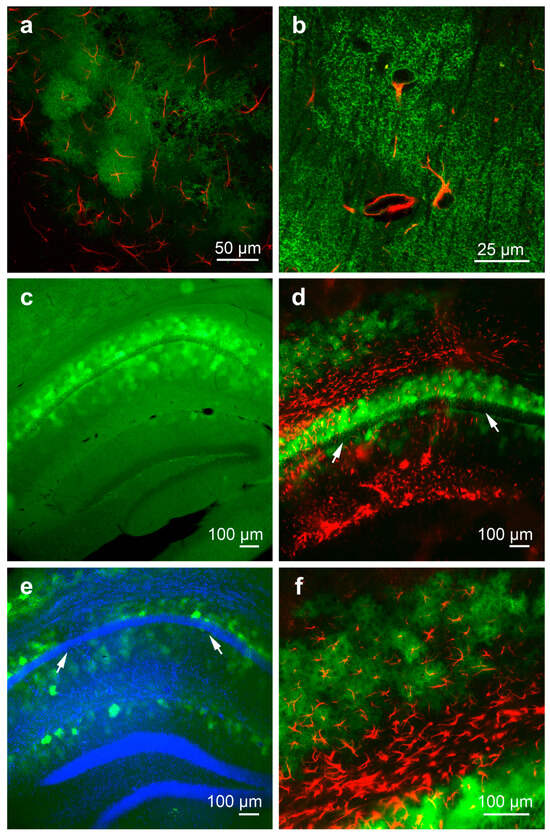 Comparison of the Transduction Capacity of AAV5 and AAV PHP.eB Serotypes in Hippocampus Astroglia