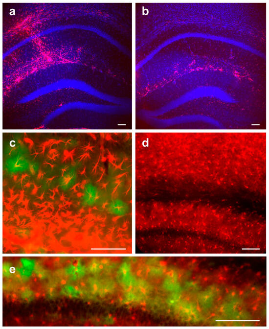 Comparison of the Transduction Capacity of AAV5 and AAV PHP.eB ...