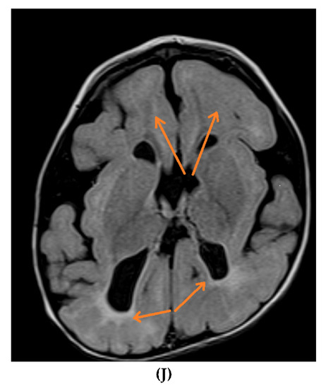 Neurology International | An Open Access Journal from MDPI