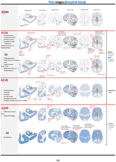 Illustrated Neuropathologic Diagnosis of Alzheimer’s Disease