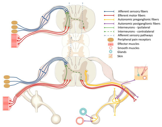 Painful Legs and Moving Toes Syndrome: Case Report and Review