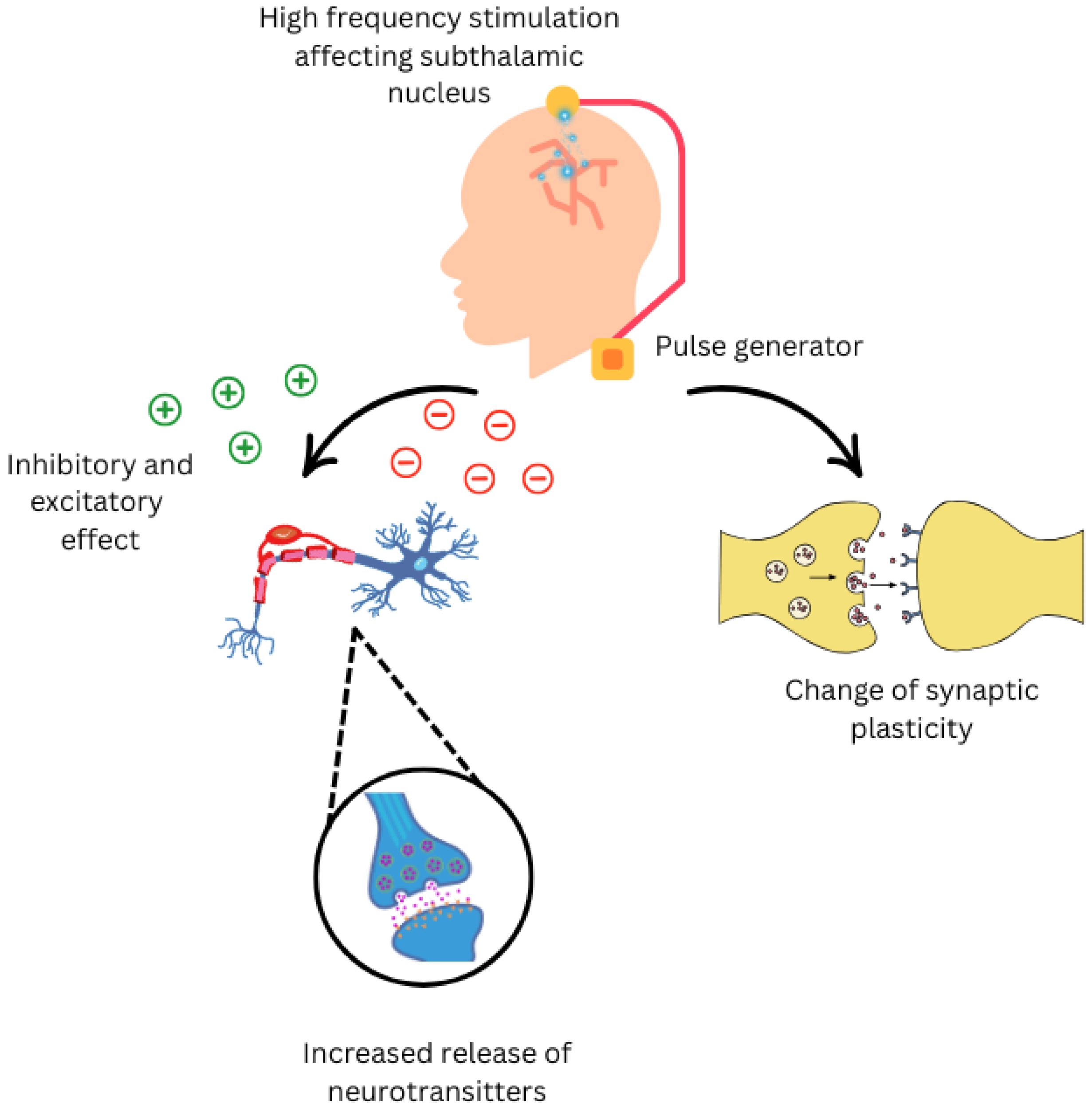 Deep Brain Stimulation: Psychological and Neuroethical Perspectives