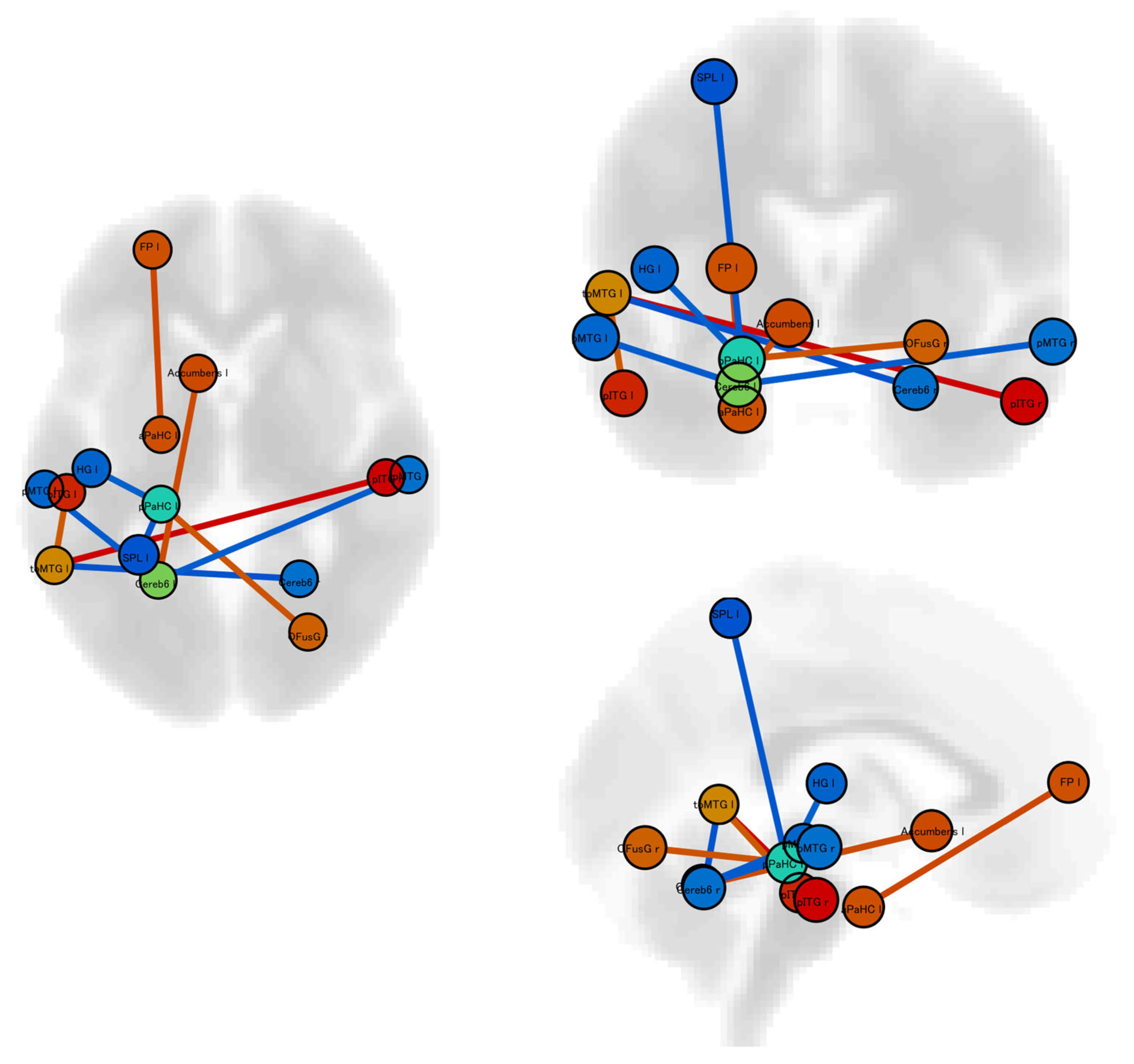 Differences in Static and Dynamic Resting-State Functional Connectivity between Migraineurs with ...