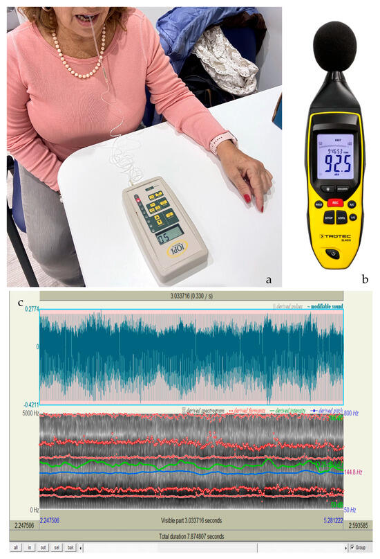 Intensive Speech Therapy for Hypokinetic Dysarthria in Parkinson’s ...