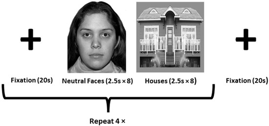 Intrinsic Functional Connectivity Alterations of the Fusiform Face Area ...