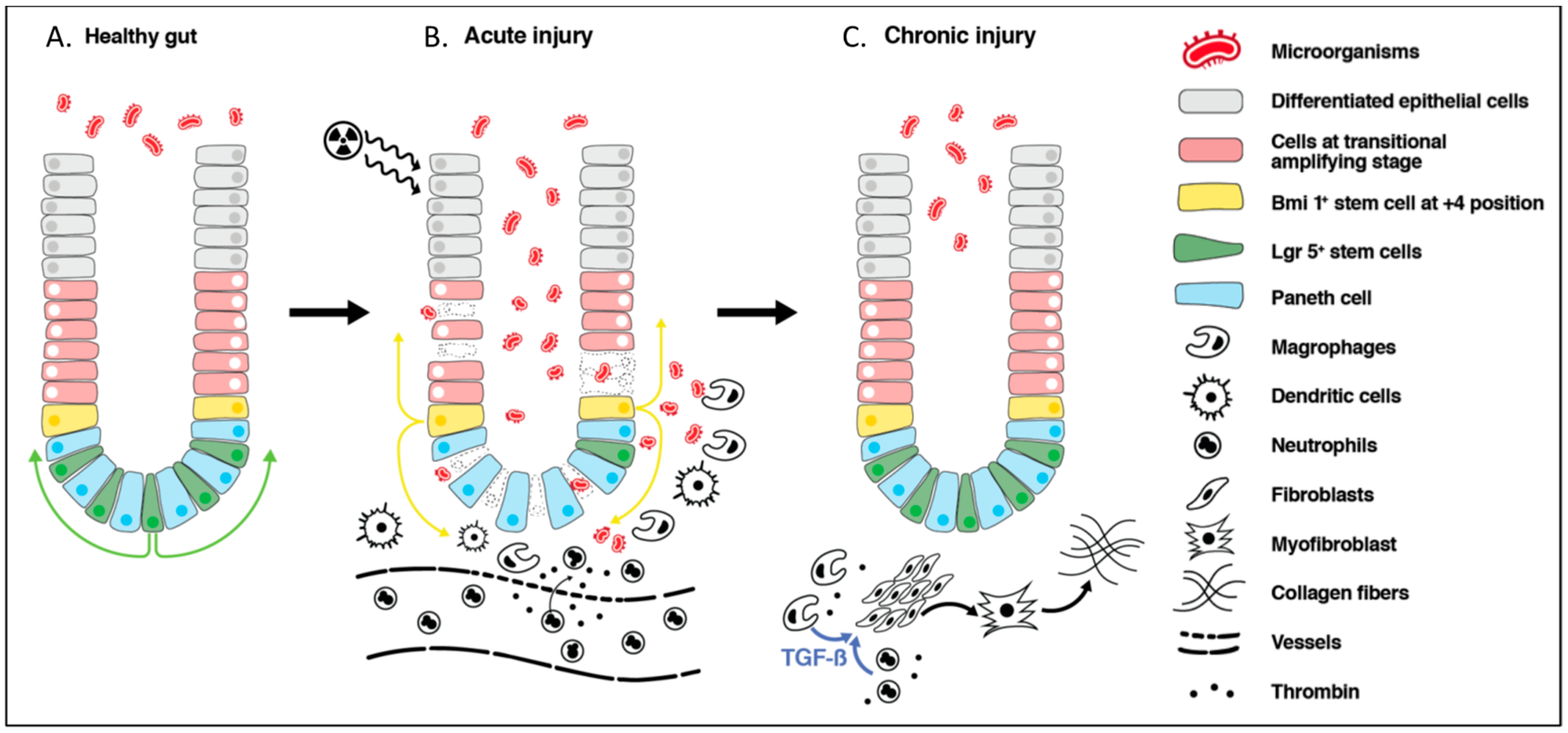 The Microbiome and Radiation Induced-Bowel Injury: Evidence for ...