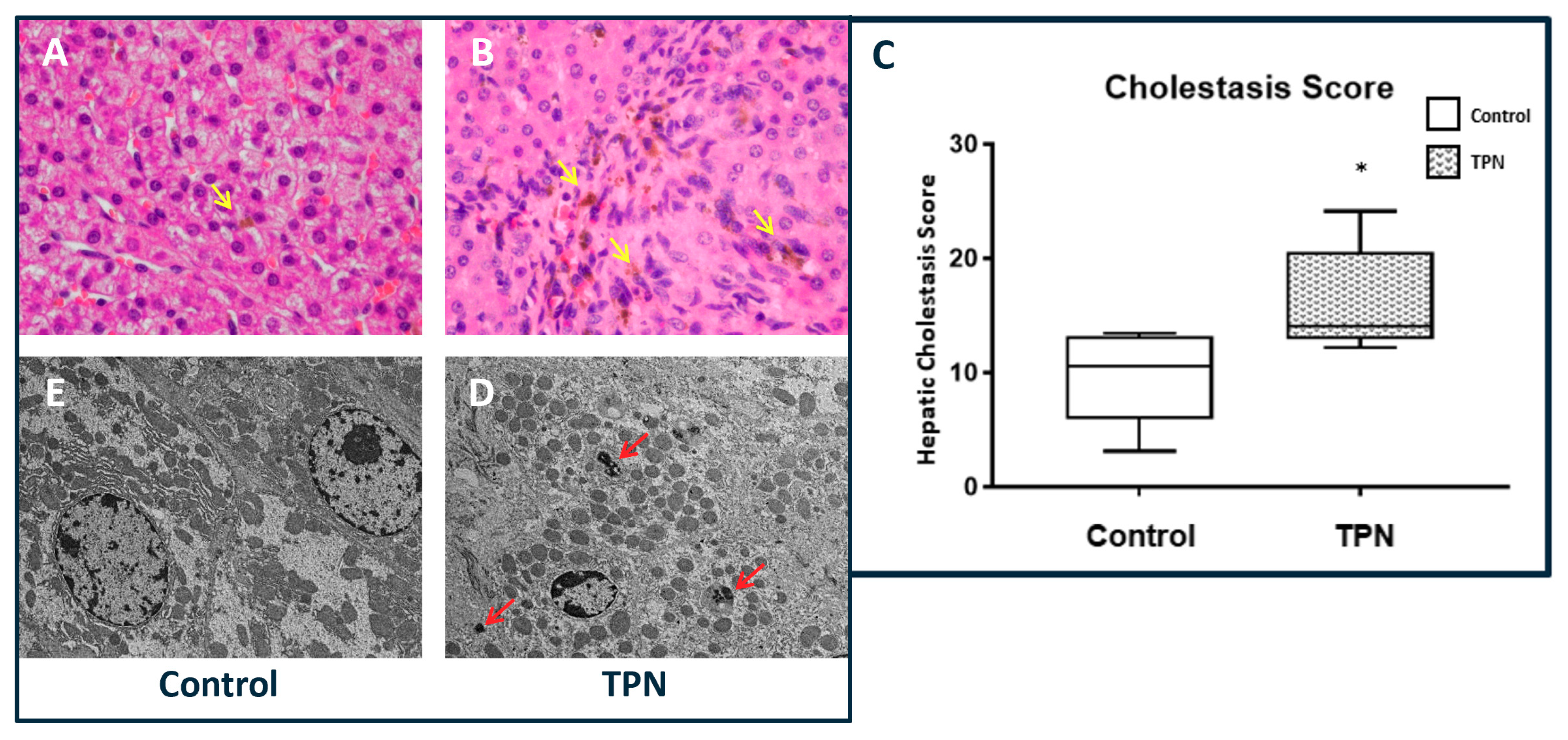 Impaired Gut–Systemic Signaling Drives Total Parenteral Nutrition ...