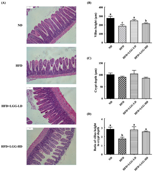 Effect of Lactobacillus rhamnosus GG on Energy Metabolism, Leptin ...