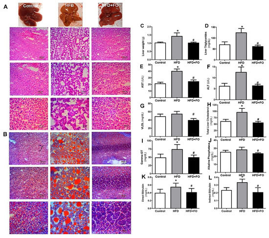 Omega-3 Polyunsaturated Fatty Acids Prevent Nonalcoholic ...