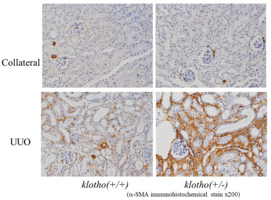 The Importance of Phosphate Control in Chronic Kidney Disease