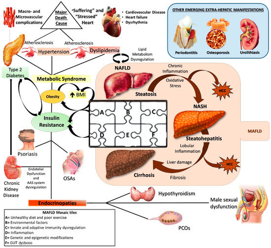 Nutrigenomics and Nutrigenetics in Metabolic- (Dysfunction) Associated ...
