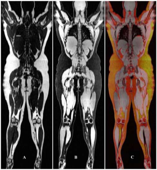 Application of Magnetic Resonance Imaging in the Evaluation of ...