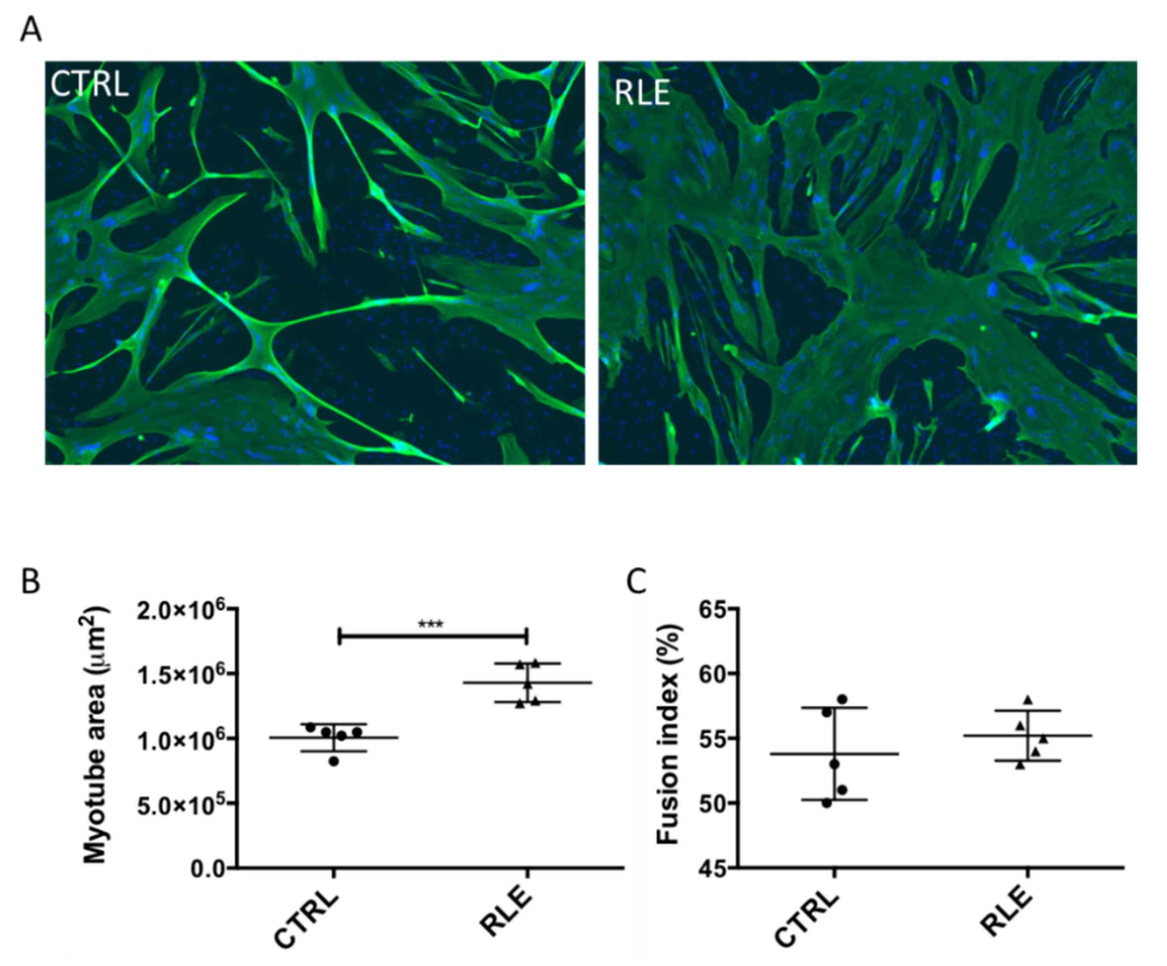 A Bioassay-Guided Fractionation of Rosemary Leaf Extract Identifies ...