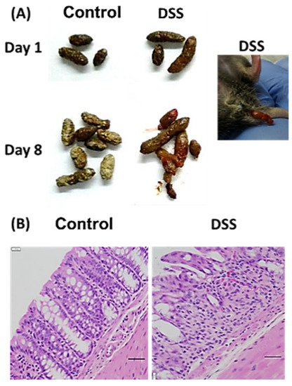 Retinoic Acid Signaling Is Compromised in DSS-Induced Dysbiosis