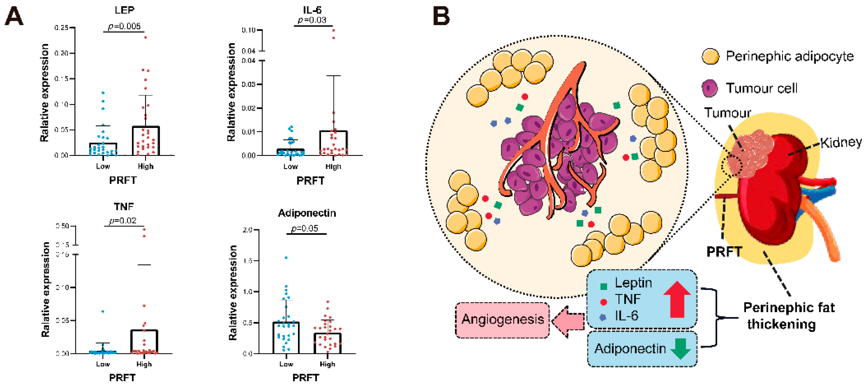 Perirenal Fat Thickness Significantly Associated with Prognosis of ...