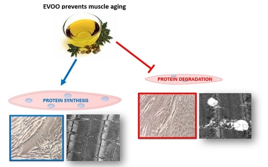 Nutrients | Free Full-Text | Extra Virgin Olive Oil (EVOO), a ...
