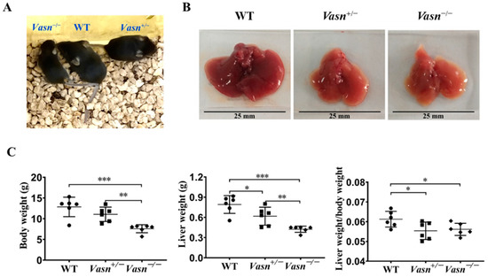 Vasorin Deletion in C57BL/6J Mice Induces Hepatocyte Autophagy through ...