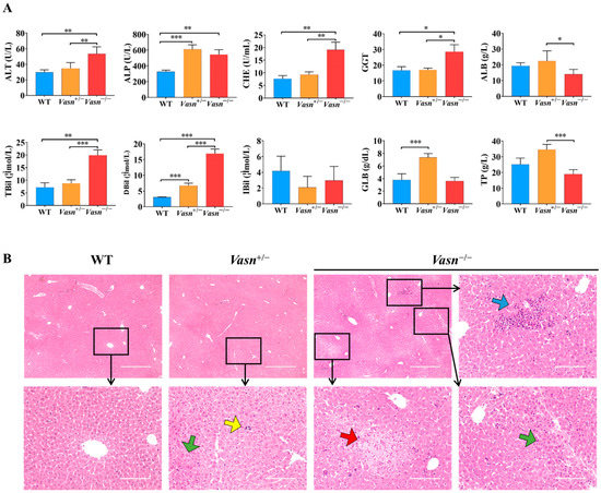 Vasorin Deletion in C57BL/6J Mice Induces Hepatocyte Autophagy through ...