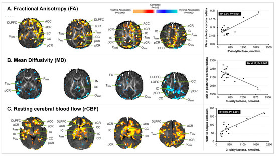 Associations of Human Milk Oligosaccharides with Infant Brain Tissue ...