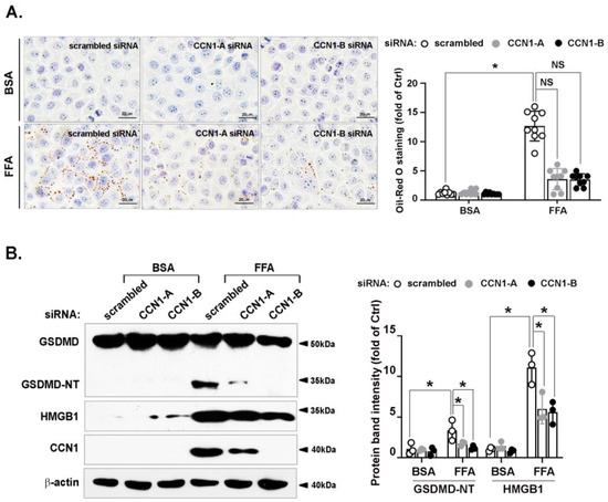 CCN1/Integrin α5β1 Instigates Free Fatty Acid-Induced Hepatocyte Lipid ...