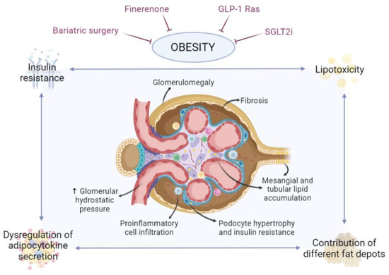 Novel Insights in the Physiopathology and Management of Obesity-Related ...