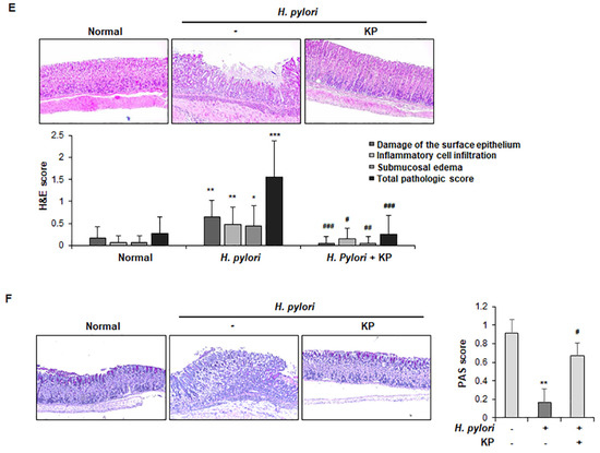 Anti-Inflammatory Effect of Korean Propolis on Helicobacter pylori ...