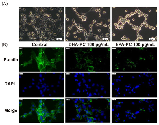 DHA- and EPA-Enriched Phosphatidylcholine Suppress Human Lung Carcinoma ...