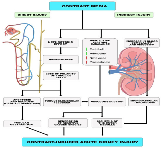 What Promotes Acute Kidney Injury in Patients with Myocardial ...