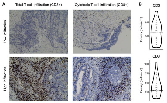 Fecal and Tissue Microbiota Are Associated with Tumor T-Cell ...