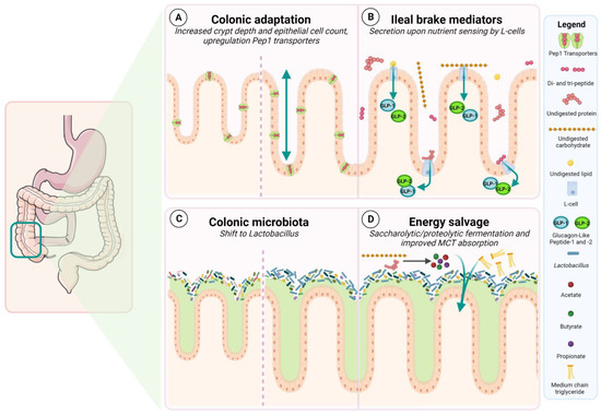 The Role of a Colon-in-Continuity in Short Bowel Syndrome