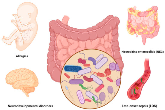 Bifidobacterium: Host–Microbiome Interaction and Mechanism of Action in Preventing Common Gut ...