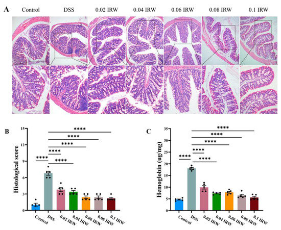 Nutrients | Free Full-Text | IRW (Ile–Arg–Trp) Alleviates DSS–Induced ...