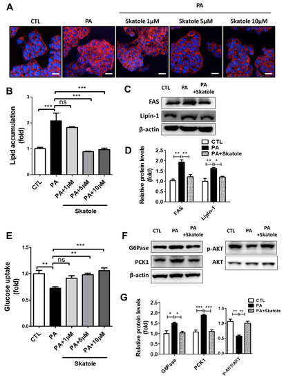 Natural Product Skatole Ameliorates Lipotoxicity-Induced Multiple ...
