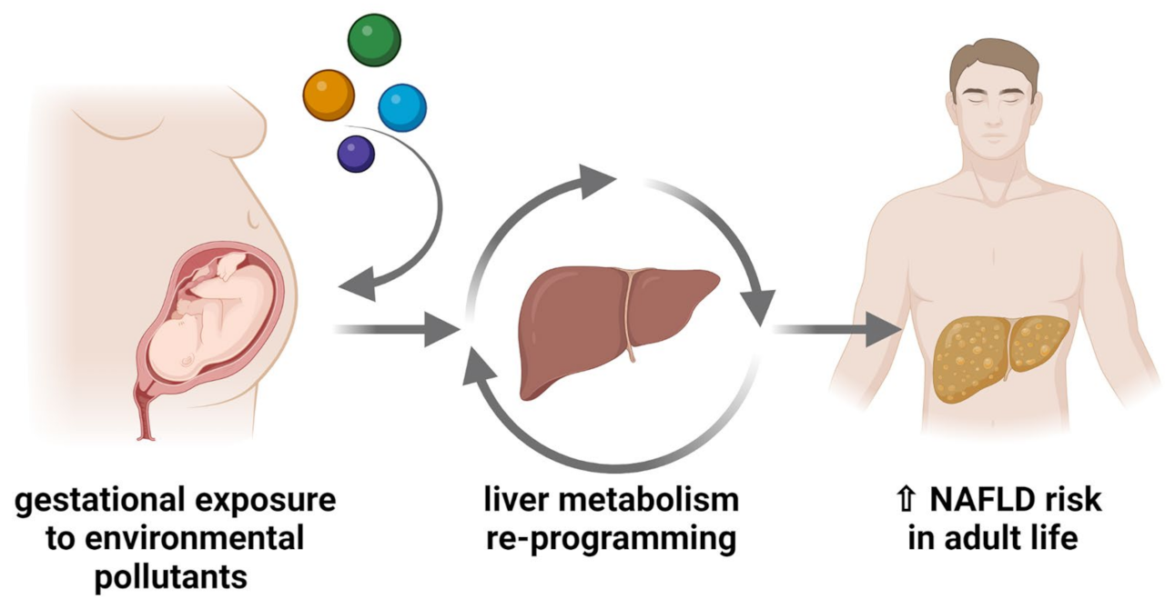 Nutrients Free Full Text Sex Nutrition And Nafld Relevance Of