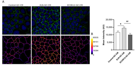 Nutrients | Free Full-Text | Modulation of the Intestinal Barrier ...