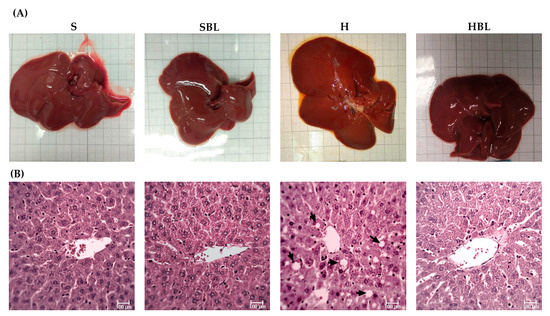 Bean Leaves Ameliorate Lipotoxicity in Fatty Liver Disease