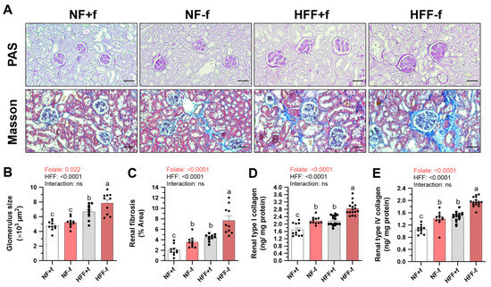 Folate Deficiency Enhanced Inflammation and Exacerbated Renal Fibrosis ...
