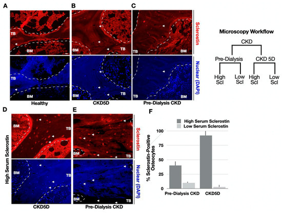Sclerostin, Osteocytes, and Wnt Signaling in Pediatric Renal Osteodystrophy