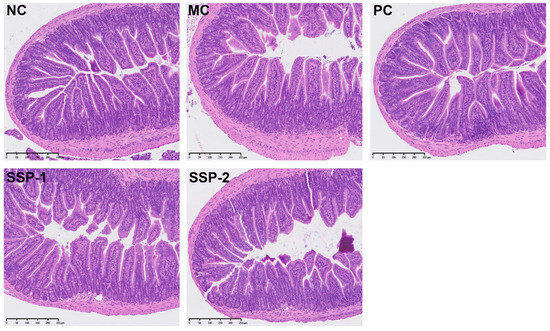 Gastrointestinal Fermentable Polysaccharide Is Beneficial in ...