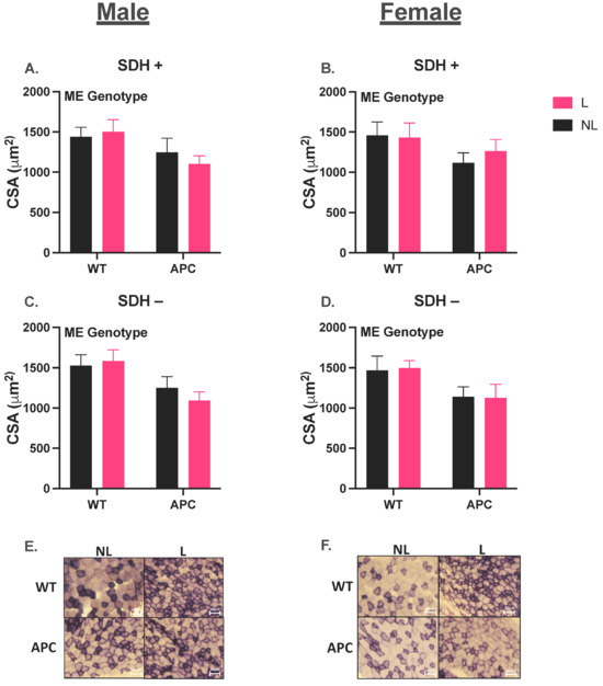 Leucine Supplementation Exacerbates Morbidity in Male but Not Female ...