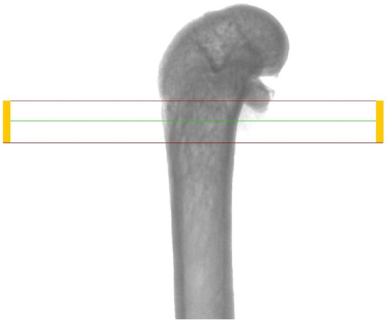Nutrients | Free Full-Text | Strontium Ranelate and Strontium Chloride ...