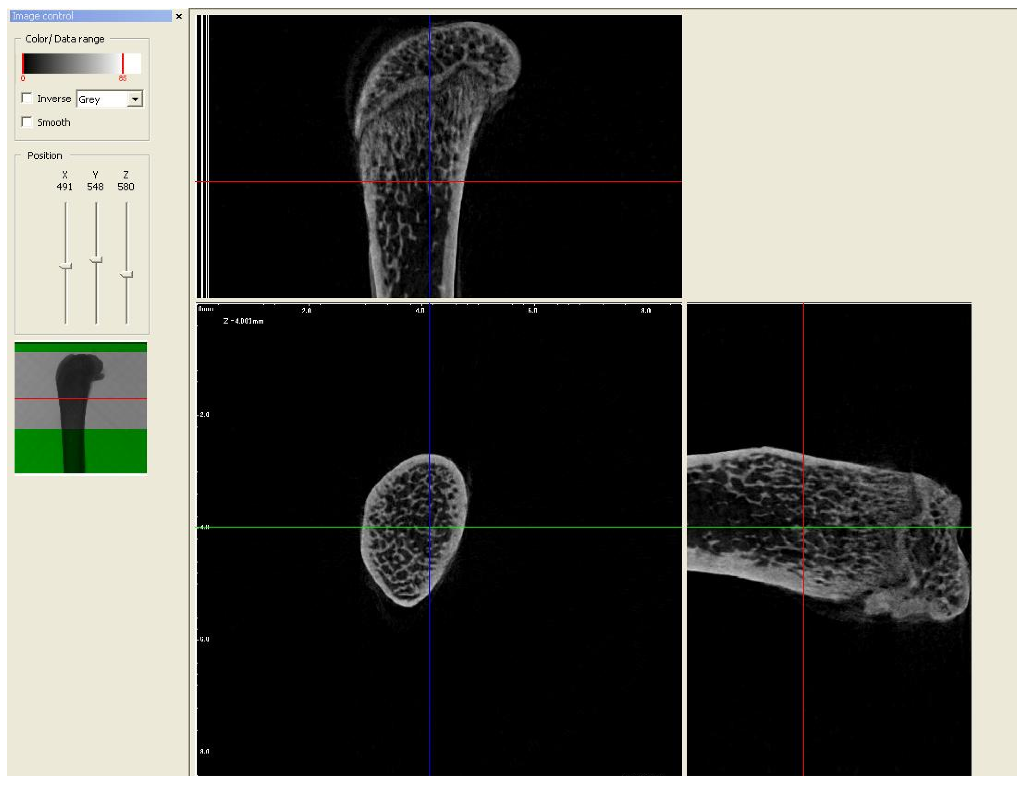 Nutrients | Free Full-Text | Strontium Ranelate and Strontium Chloride ...