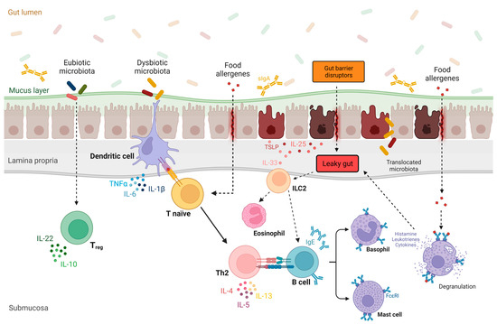 The Role of Gut Microbiota and Leaky Gut in the Pathogenesis of Food ...