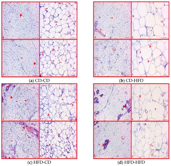 The Effect of Maternal High-Fat Diet on Adipose Tissue Histology and ...
